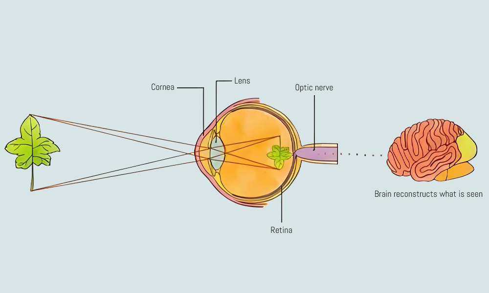How retinal detachment is caused